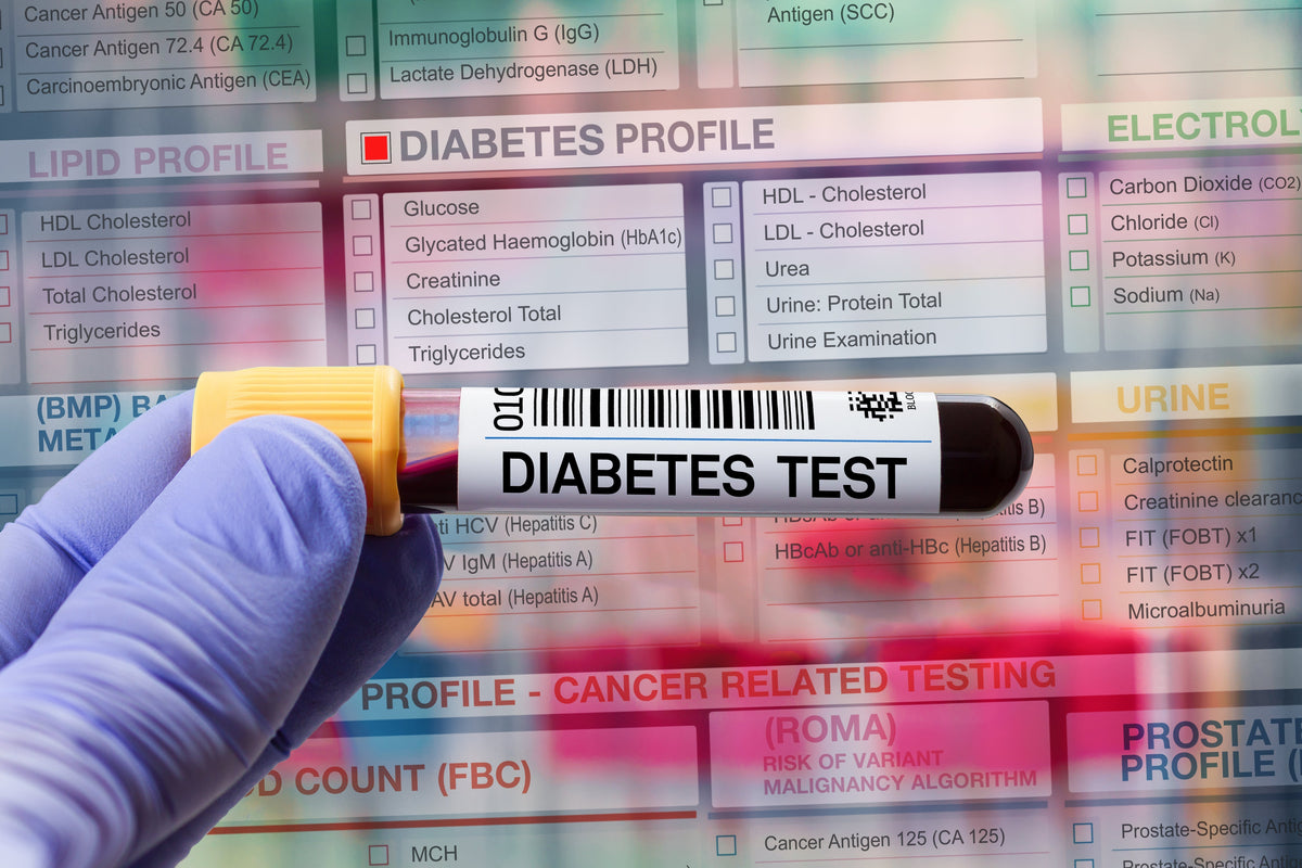 Homeostatic Model Assessment Insulin Resistance 2 (HOMA-2) — TodaTuSalud.es